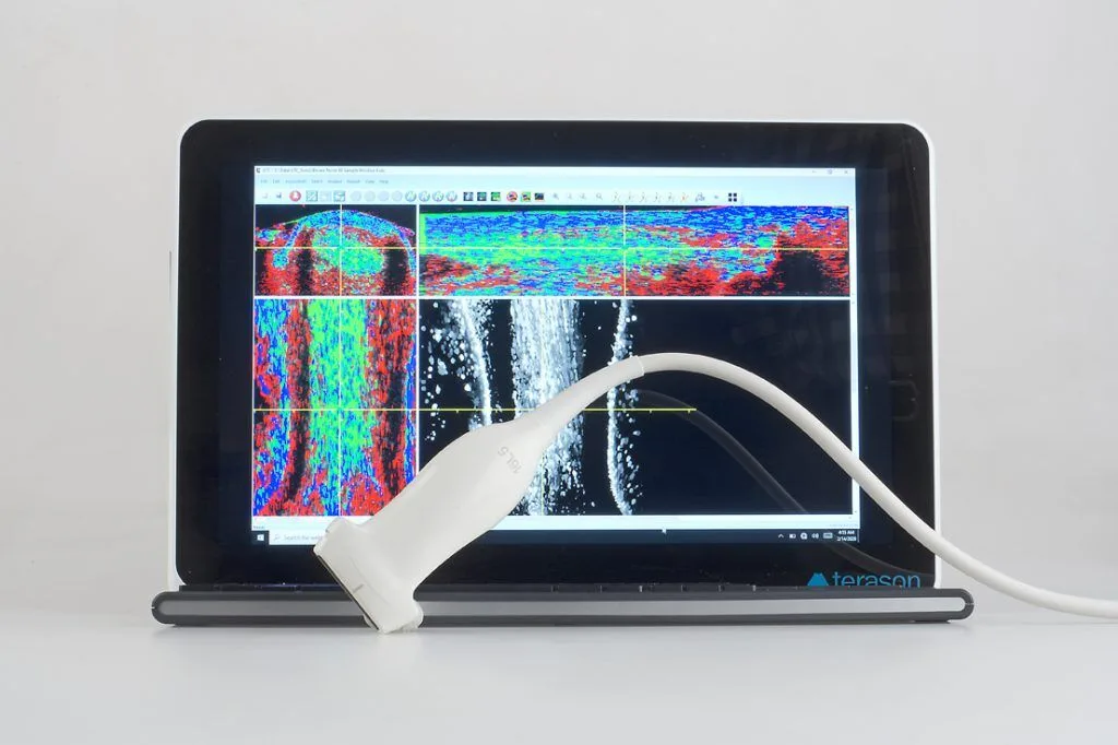 Terason Tablet Ultrasound System - UTC Imaging