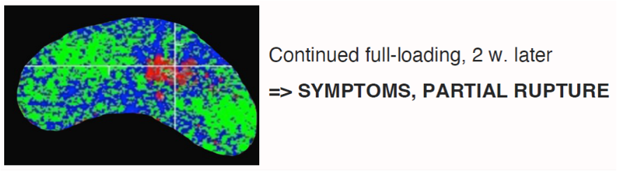 UTC Case Study: A Premier League Footballer's Injury Journey - UTC Imaging